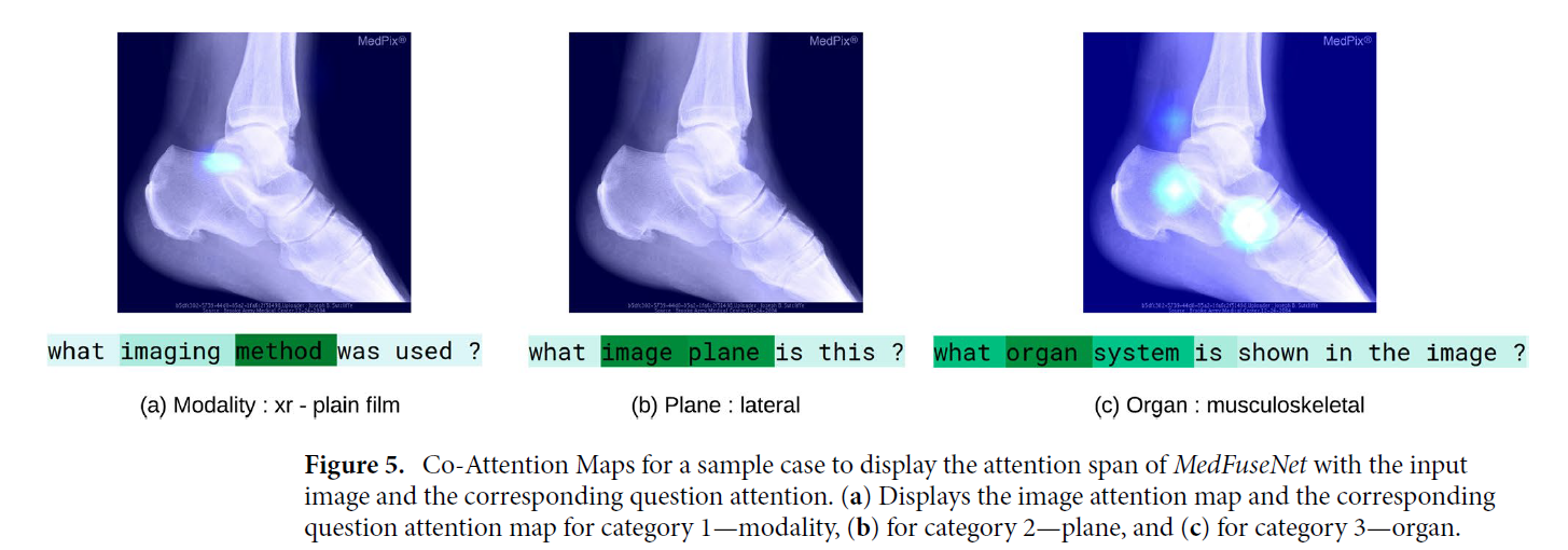 [논문리뷰] MedFuseNet: An attention-based multimodal deep learning model for visual question ...